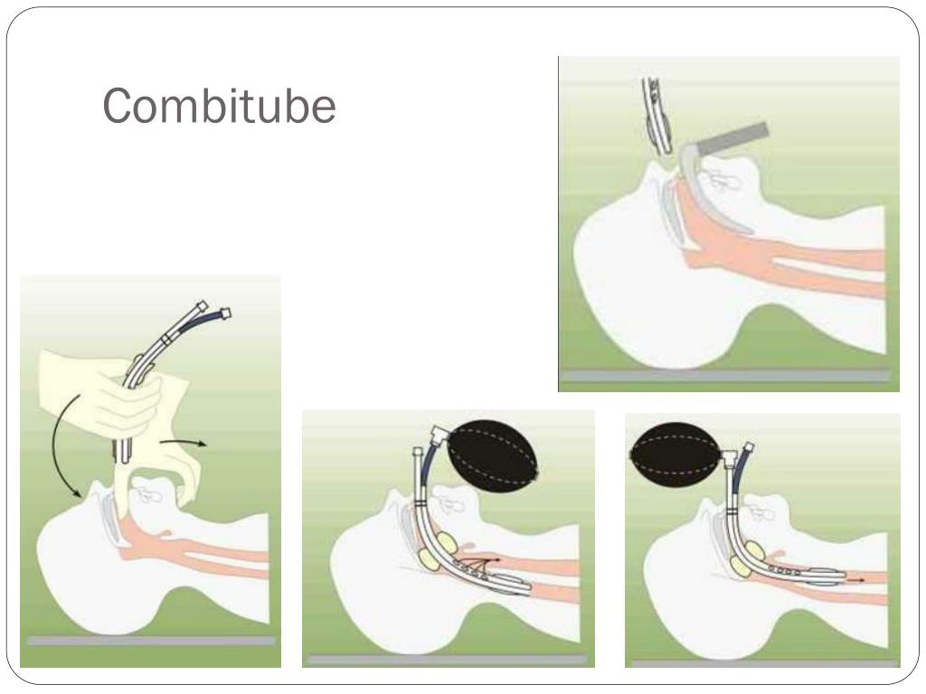 PPT - INTUBAÇÃO ENDOTRAQUEAL, VIA AÉREA DIFÍCIL, CRICOTIREOIDOSTOMIA E ...