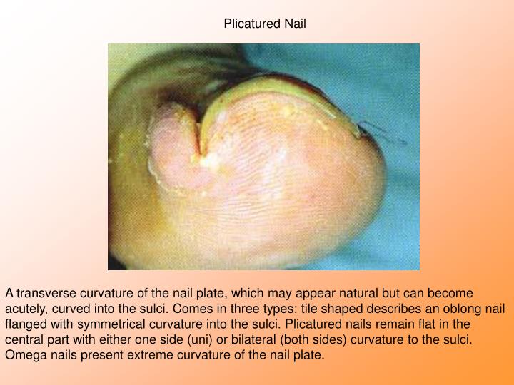 PPT - The most commonly reported nail conditions, seen by podiatrists ...