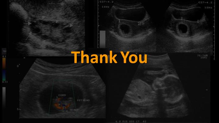 PPT - Xray and USG PowerPoint Presentation - ID:6346934