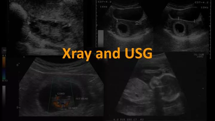 PPT - Xray and USG PowerPoint Presentation, free download - ID:6346934