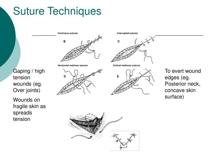 PPT - Wound Management PowerPoint Presentation - ID:6347177