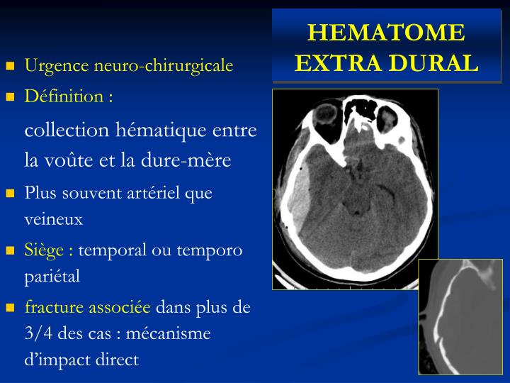 PPT - TRAUMATISMES CRÂNIO-ENCEPHALIQUES PowerPoint Presentation - ID ...