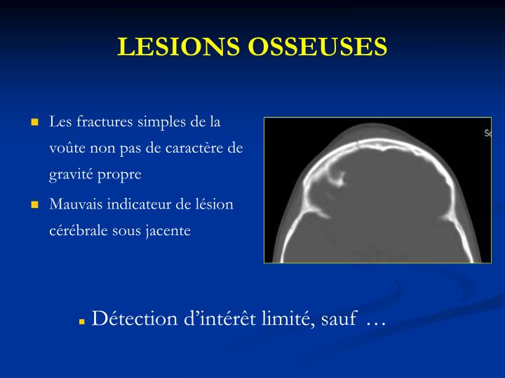 PPT - TRAUMATISMES CRÂNIO-ENCEPHALIQUES PowerPoint Presentation - ID ...