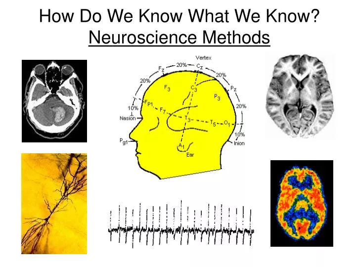 PPT - How Do We Know What We Know? Neuroscience Methods PowerPoint ...