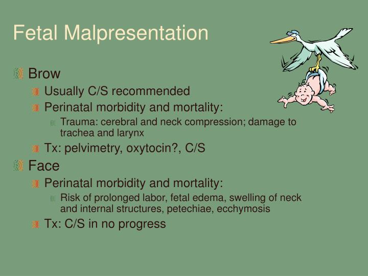 PPT - Complication o Labor PowerPoint Presentation - ID:6355410