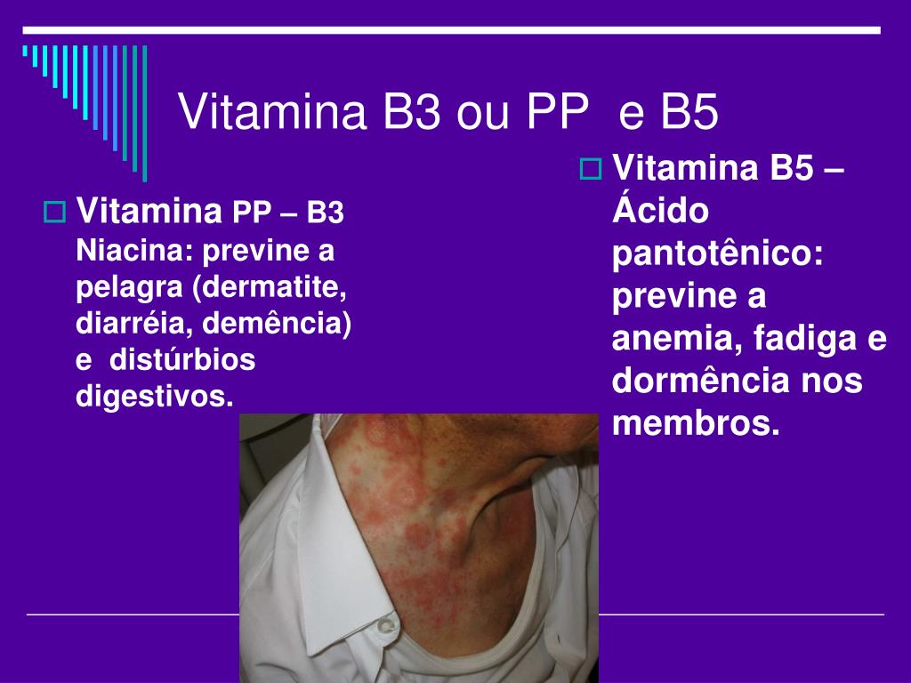 PPT - BIOQUÍMICA 4 - PROTEÍNAS PowerPoint Presentation, free download ...
