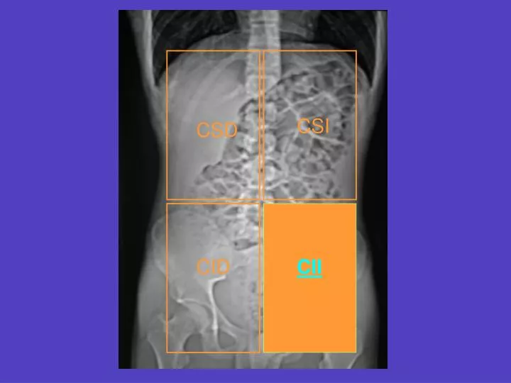 PPT - CII PowerPoint Presentation, free download - ID:6357924