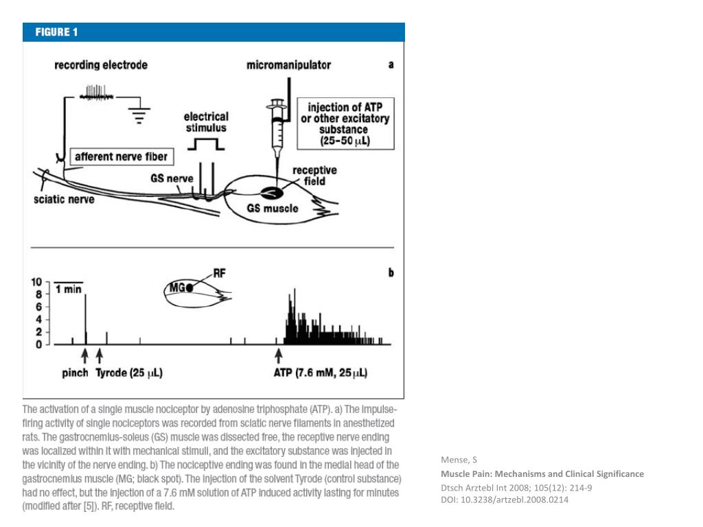 PPT - Mense , S Muscle Pain: Mechanisms and Clinical Significance ...