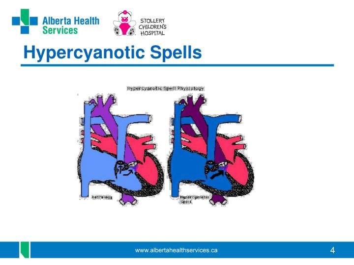 PPT - Pathophysiology and Management of Hypercyanotic or TET spells ...