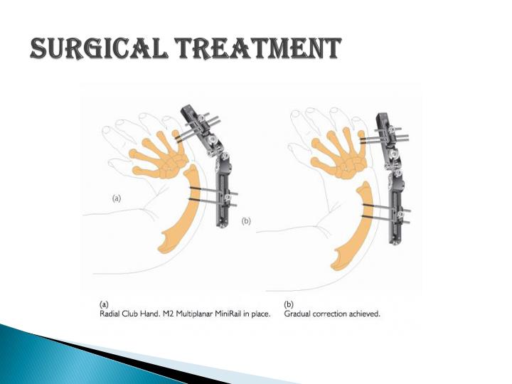 PPT - Radial Club Hand PowerPoint Presentation - ID:6363087