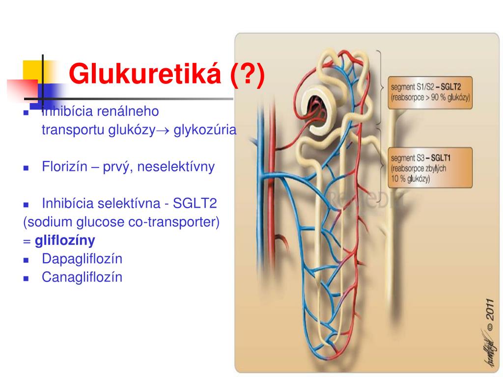 PPT - Diabetes mellitus PowerPoint Presentation, free download - ID:6367764