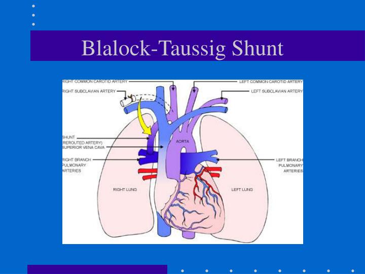 PPT - Congenital Heart Disease PowerPoint Presentation - ID:6369811