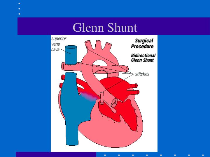 PPT - Congenital Heart Disease PowerPoint Presentation - ID:6369811