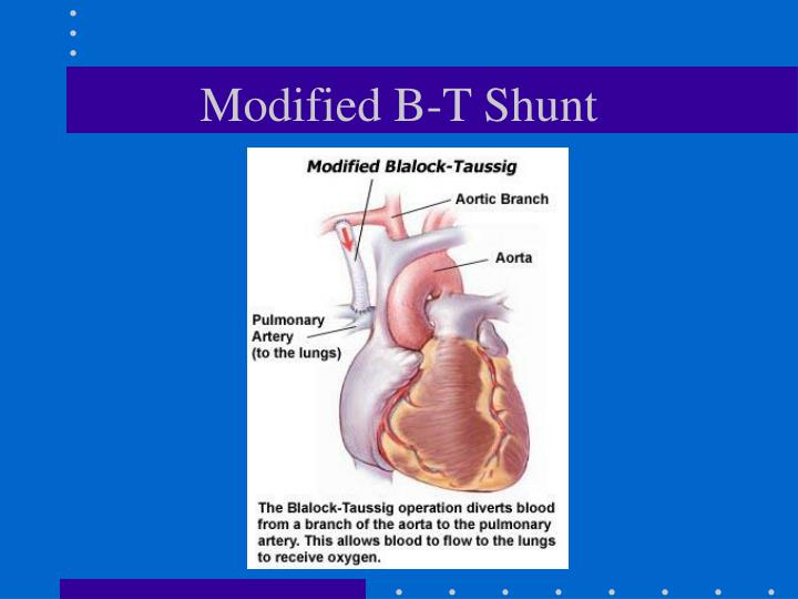 PPT - Congenital Heart Disease PowerPoint Presentation - ID:6369811