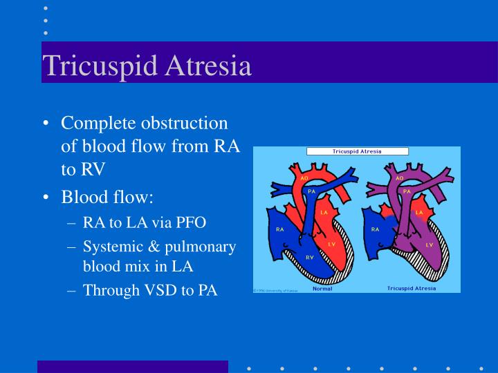 PPT - Congenital Heart Disease PowerPoint Presentation - ID:6369811