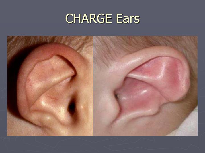 Charge syndrome genital abnormalities - desertmery