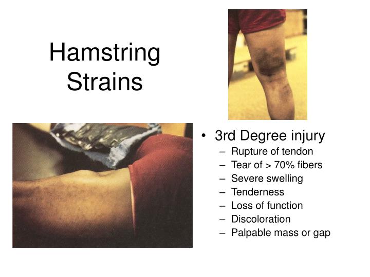 PPT - The Thigh and Hip Muscles Anatomy, Injuries and Assessment ...