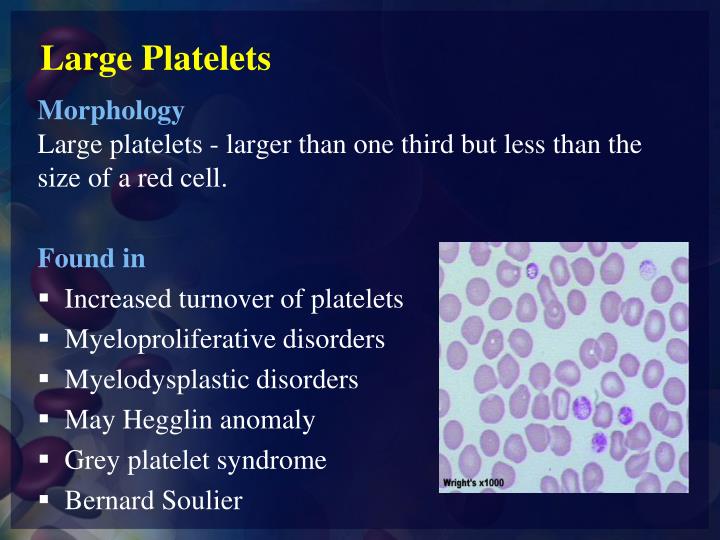 PPT - WBCs & PLT Abnormal Morphology PowerPoint Presentation - ID:6378150