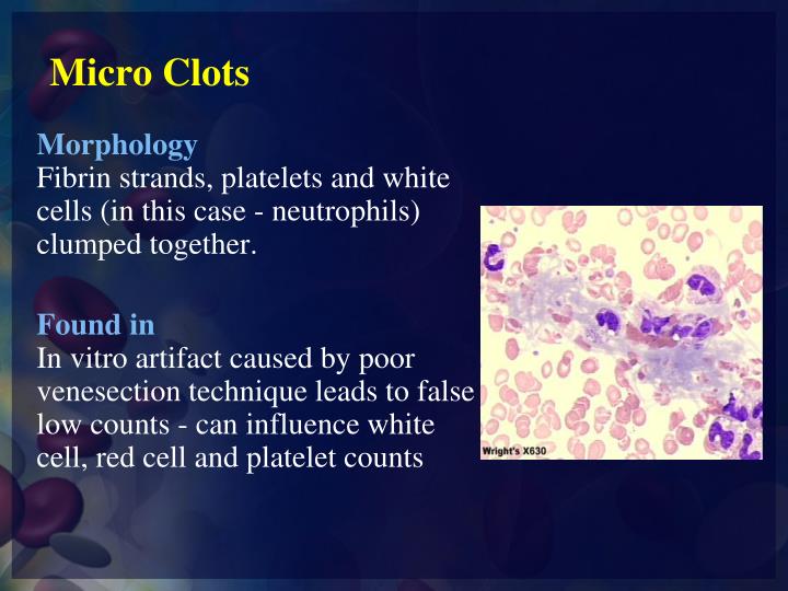 PPT - WBCs & PLT Abnormal Morphology PowerPoint Presentation - ID:6378150