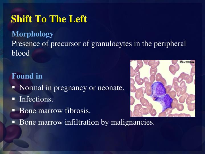 PPT - WBCs & PLT Abnormal Morphology PowerPoint Presentation - ID:6378150