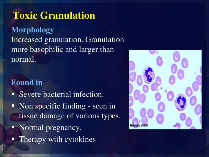 PPT - WBCs & PLT Abnormal Morphology PowerPoint Presentation - ID:6378150