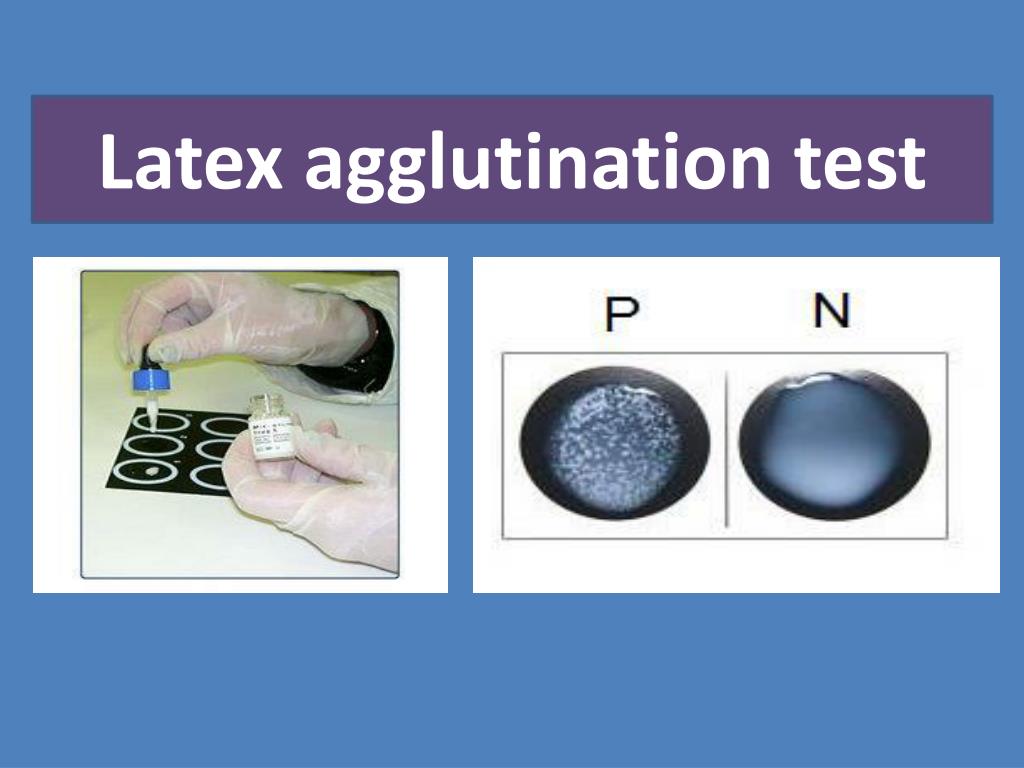 Latex Agglutination Test Definition Procedure Princip - vrogue.co Latex Agglutination Test Definition Procedure Princip - vrogue.co