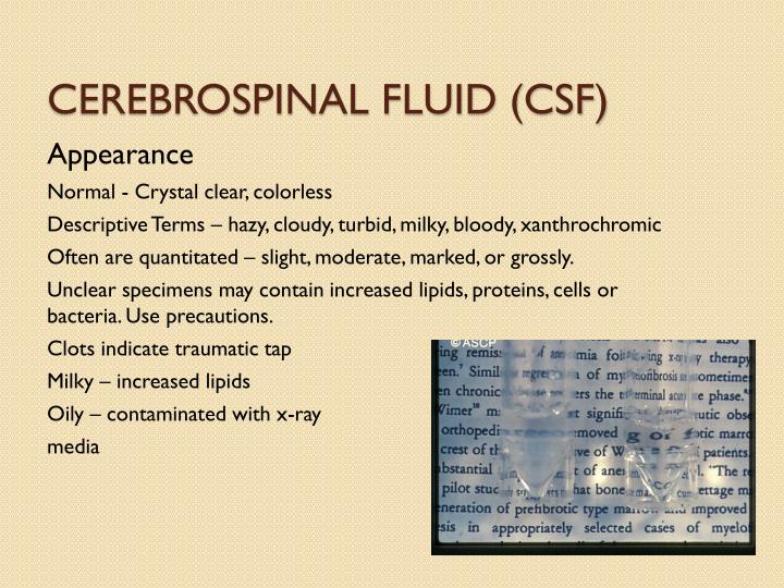 PPT - CEREBROSPINAL FLUID BY Hossam HASSAN PowerPoint Presentation - ID ...