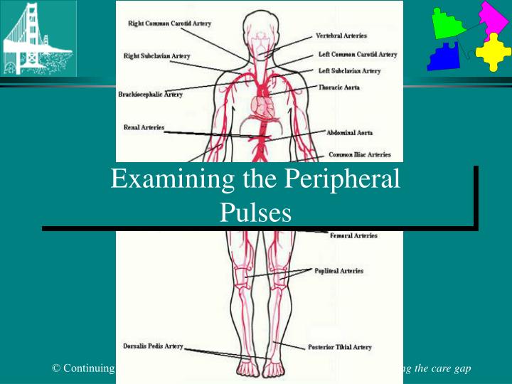 PPT - How to Examine the Heart and Blood Vessels PowerPoint ...
