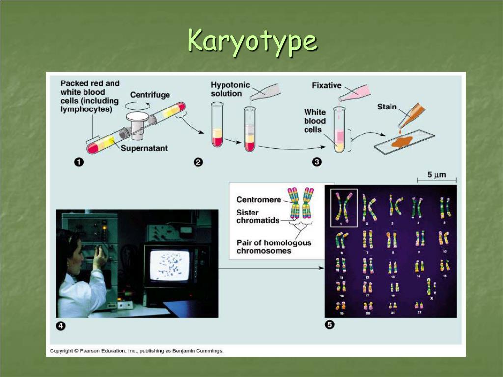 Ppt Genetic Disorders Powerpoint Presentation Free Download Id 6387428