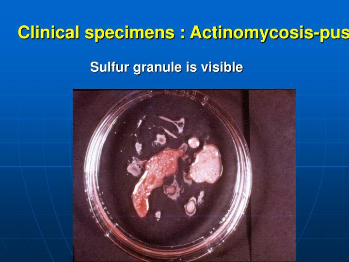 PPT - Actinomyces and Nocardia PowerPoint Presentation - ID:6391123