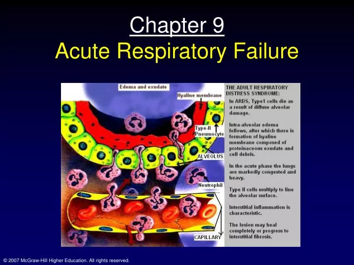 PPT - Chapter 9 Acute Respiratory Failure PowerPoint Presentation, free ...