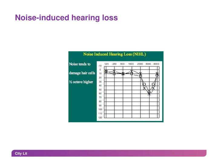 Ppt Hearing Loss And Audiograms Powerpoint Presentation Id 6392845