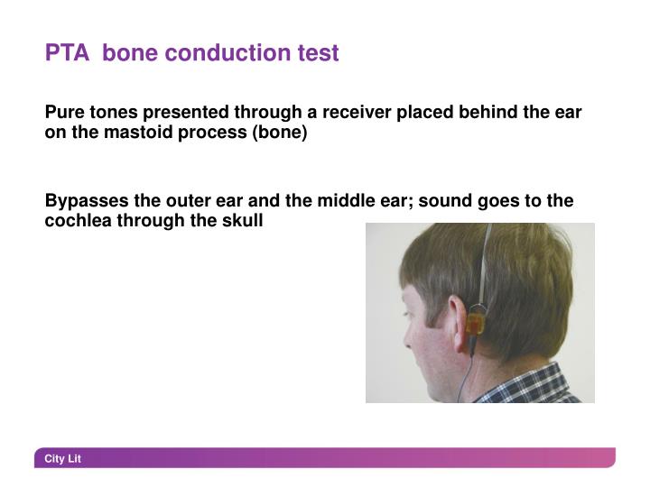 PPT - Hearing loss and audiograms PowerPoint Presentation - ID:6392845