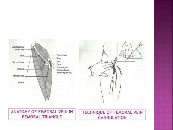 PPT - CVP measurement- III PowerPoint Presentation - ID:6398063