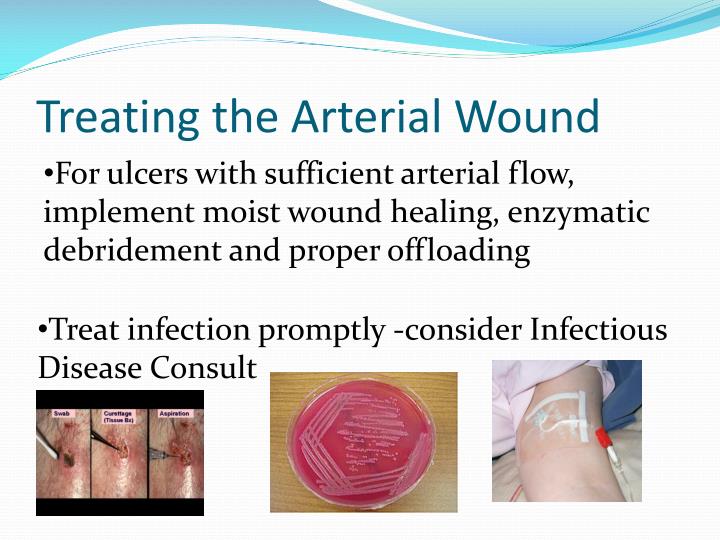PPT - Ulcerations Due to Peripheral Vascular Disease PowerPoint ...
