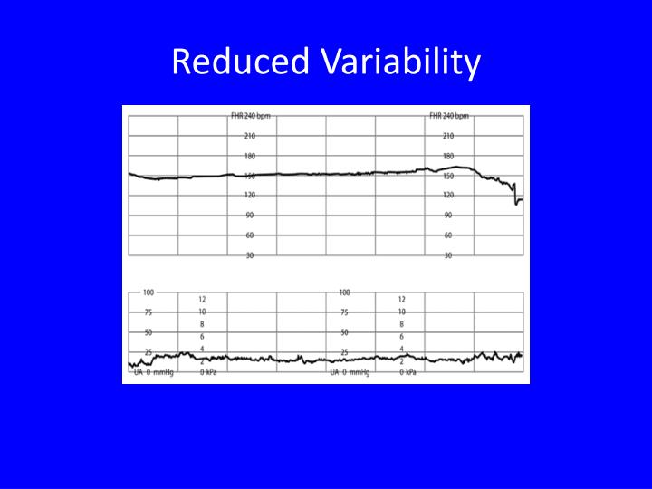 PPT - CTG Interpretation and Management PowerPoint Presentation - ID ...