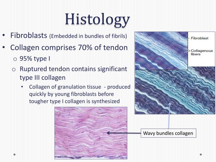 PPT - Achilles Tendon Injuries PowerPoint Presentation - ID:6408022