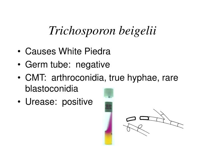PPT - Mycology – Yeast PowerPoint Presentation - ID:6409451