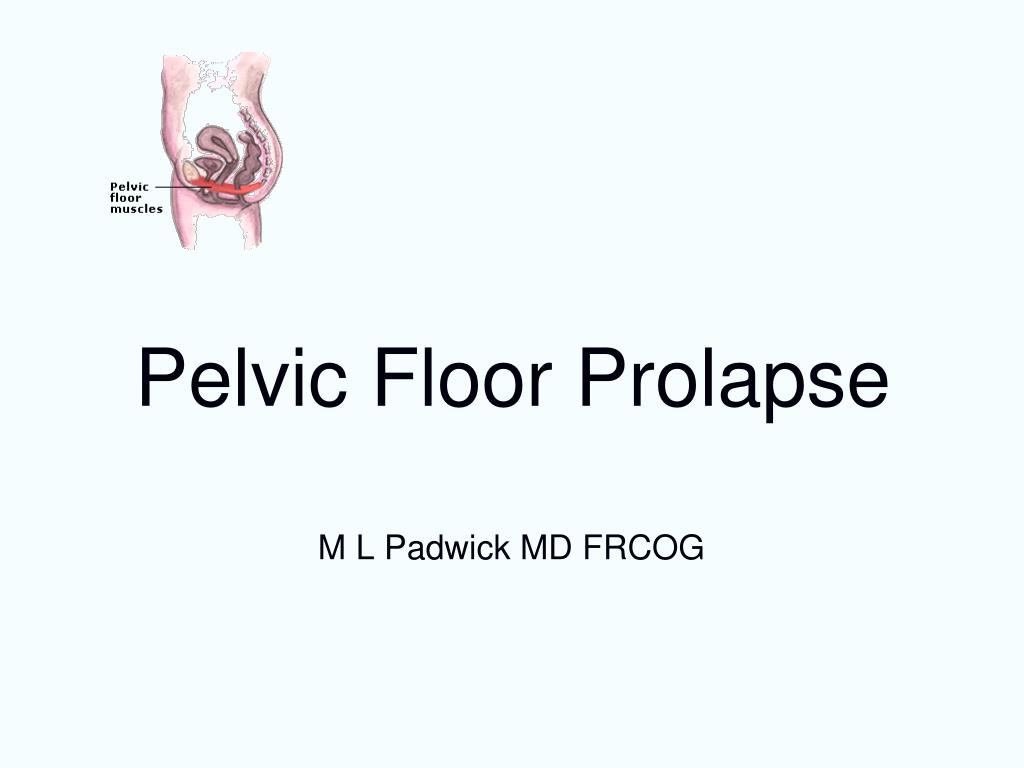 Ppt Pelvic Floor Prolapse Powerpoint Presentation Free Download Id