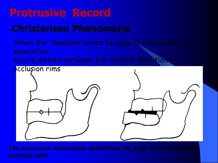 PPT - TEMPROMANDIBULAR JOINT AND MOVEMENTS MANDIBULAR [ T M J ...
