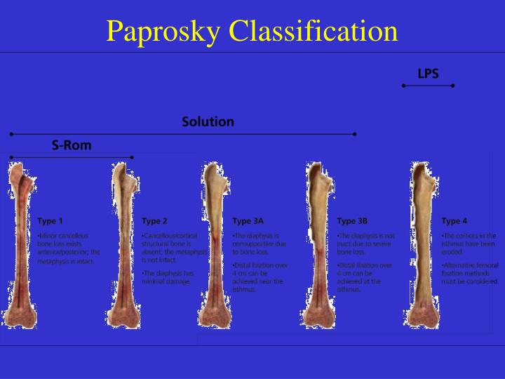 PPT - Femoral Deformity and Deficiency in Complex Primary & Revision ...