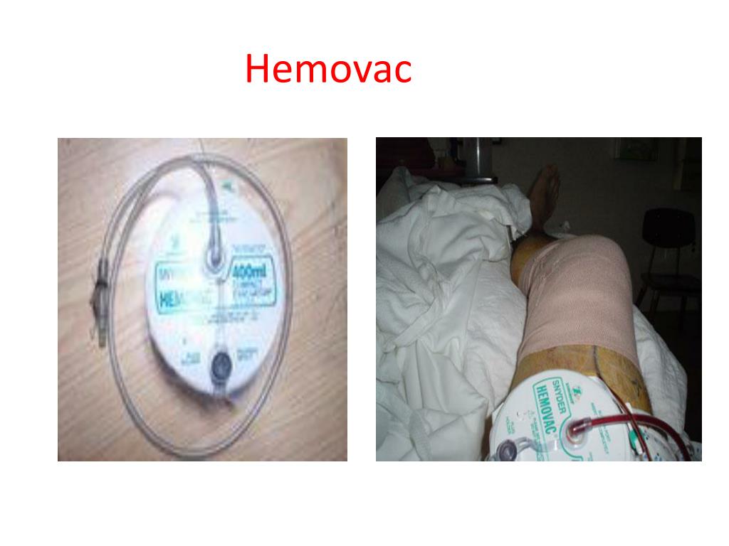 PPT - Sterile Dressings PowerPoint Presentation, free download - ID:6417924