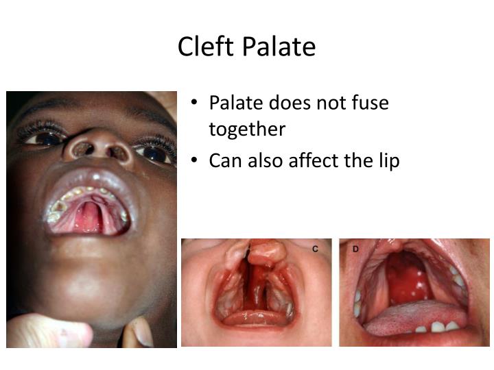 PPT - The Respiratory System PowerPoint Presentation - ID:6418158