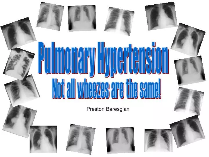 PPT - Pulmonary Hypertension PowerPoint Presentation, free download ...