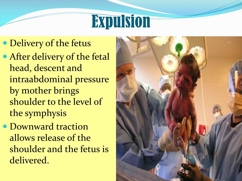 PPT - Physiology of delivery. Analgesia in labor. PowerPoint ...