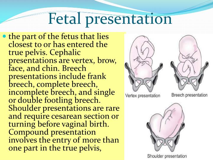 PPT - Physiology of delivery. Analgesia in labor. PowerPoint ...