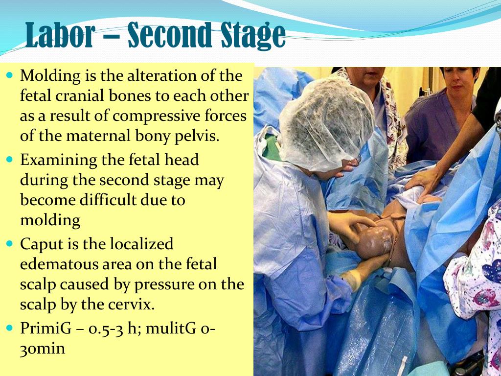 PPT - Physiology of delivery. Analgesia in labor. PowerPoint ...