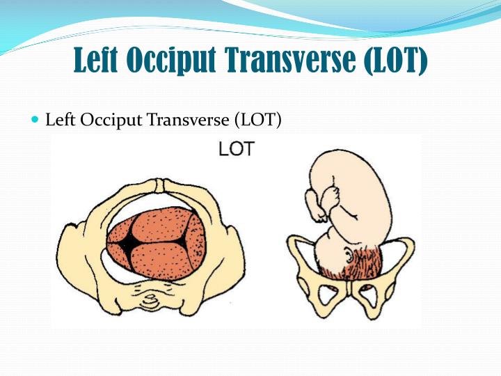 PPT - Physiology of delivery. Analgesia in labor. PowerPoint ...