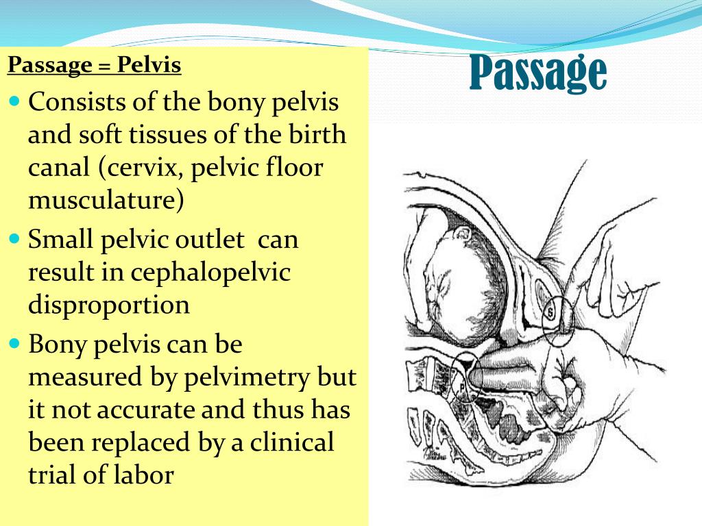 PPT - Physiology of delivery. Analgesia in labor. PowerPoint ...