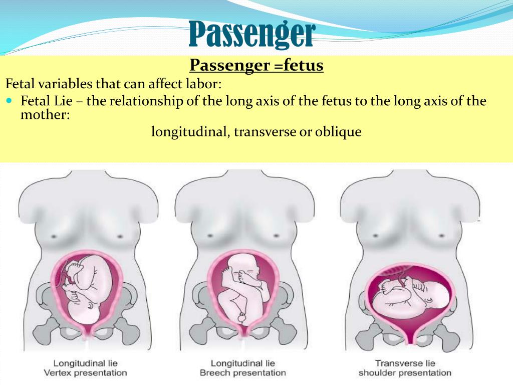 PPT - Physiology of delivery. Analgesia in labor. PowerPoint ...